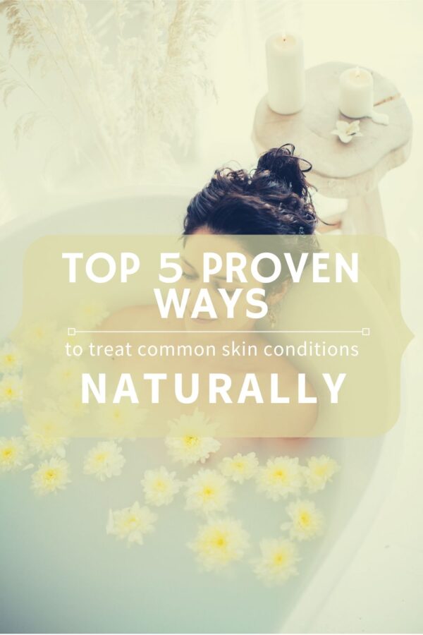 Top 5 proven ways to treat common skin conditions naturally - Seven Roses